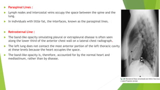 THE MEDIASTENUM anatomy in radiology.pptx