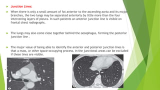 THE MEDIASTENUM anatomy in radiology.pptx
