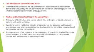 THE MEDIASTENUM anatomy in radiology.pptx