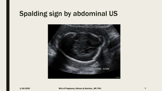 The medicolegal aspects of pregnancy, delivery and abortion | PPTX