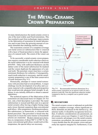 All Ceramic Crown Preparation