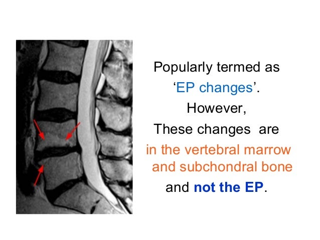 The modic vertebral endplate and marrow changes (spine 2010)