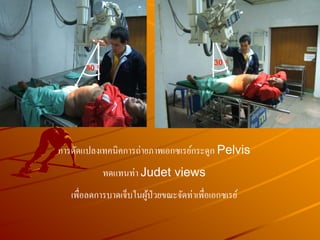 The modification plain radiographic of pelvis | PDF