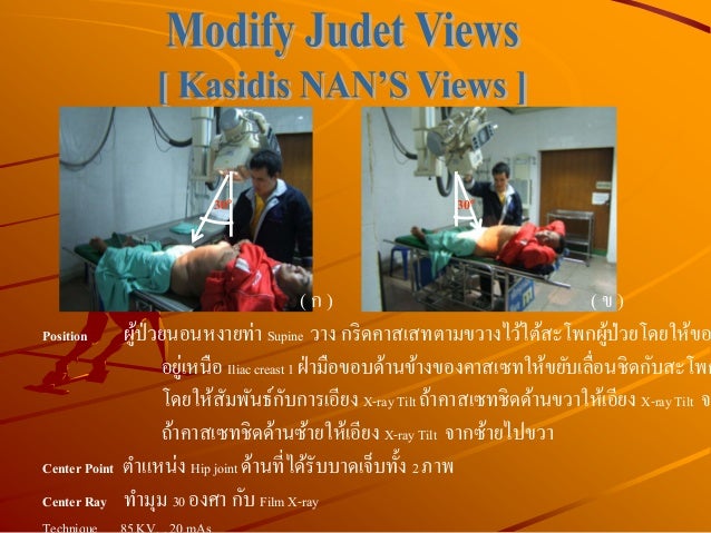 The modification plain radiographic of pelvis