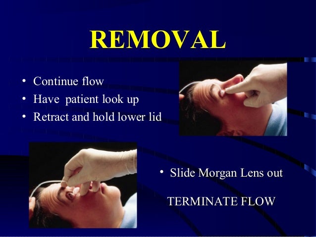 Morgan Lens for ALS Providers