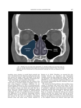 The morphological interaction between the nasal cavity and maxillary ...