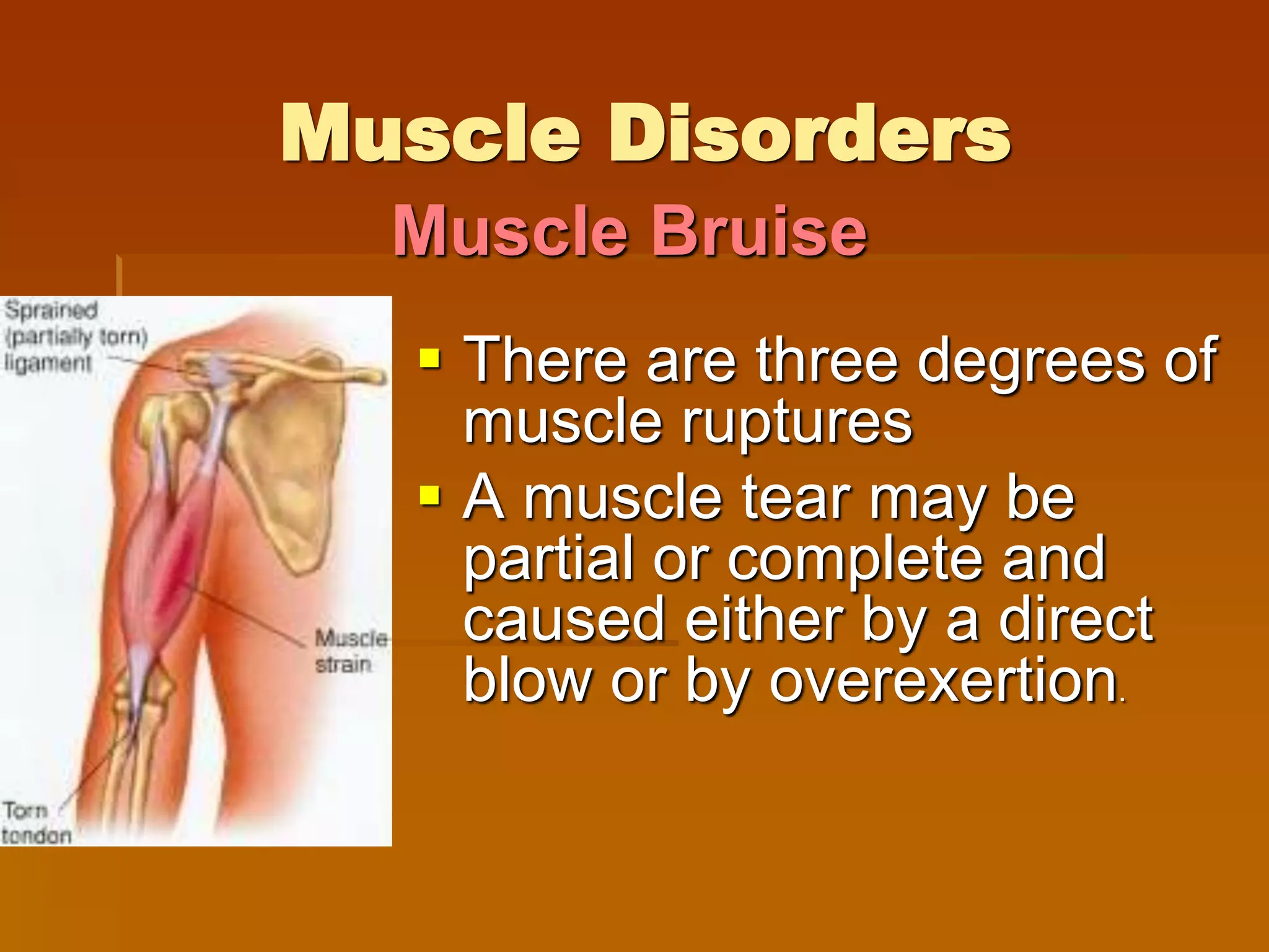 The muscle system disorder | PPTX