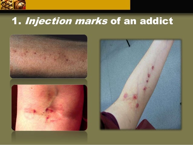 The Nature of drug and drug abuse