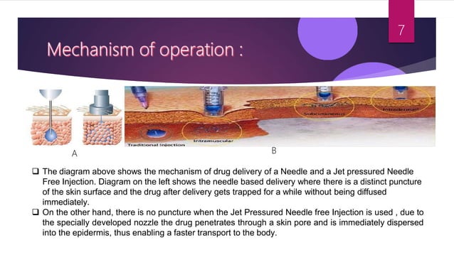 theneedlefreeinjectiontechnology-181030132529.pptx