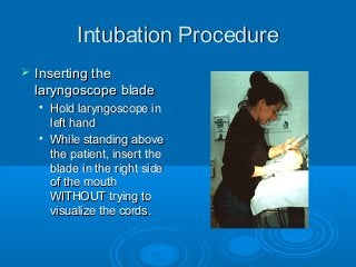 The neonatal airway | PPT