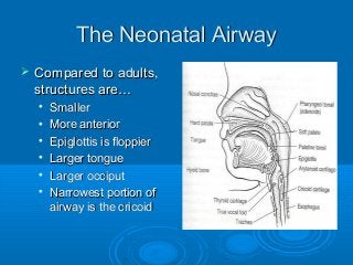 The neonatal airway | PPT