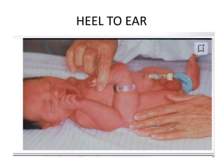 THE NEONATE NEW BALLARD SCORING SYSTEM .pptx