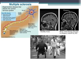 Anatomy & Physiology Lecture Notes - The nervous system | PPT