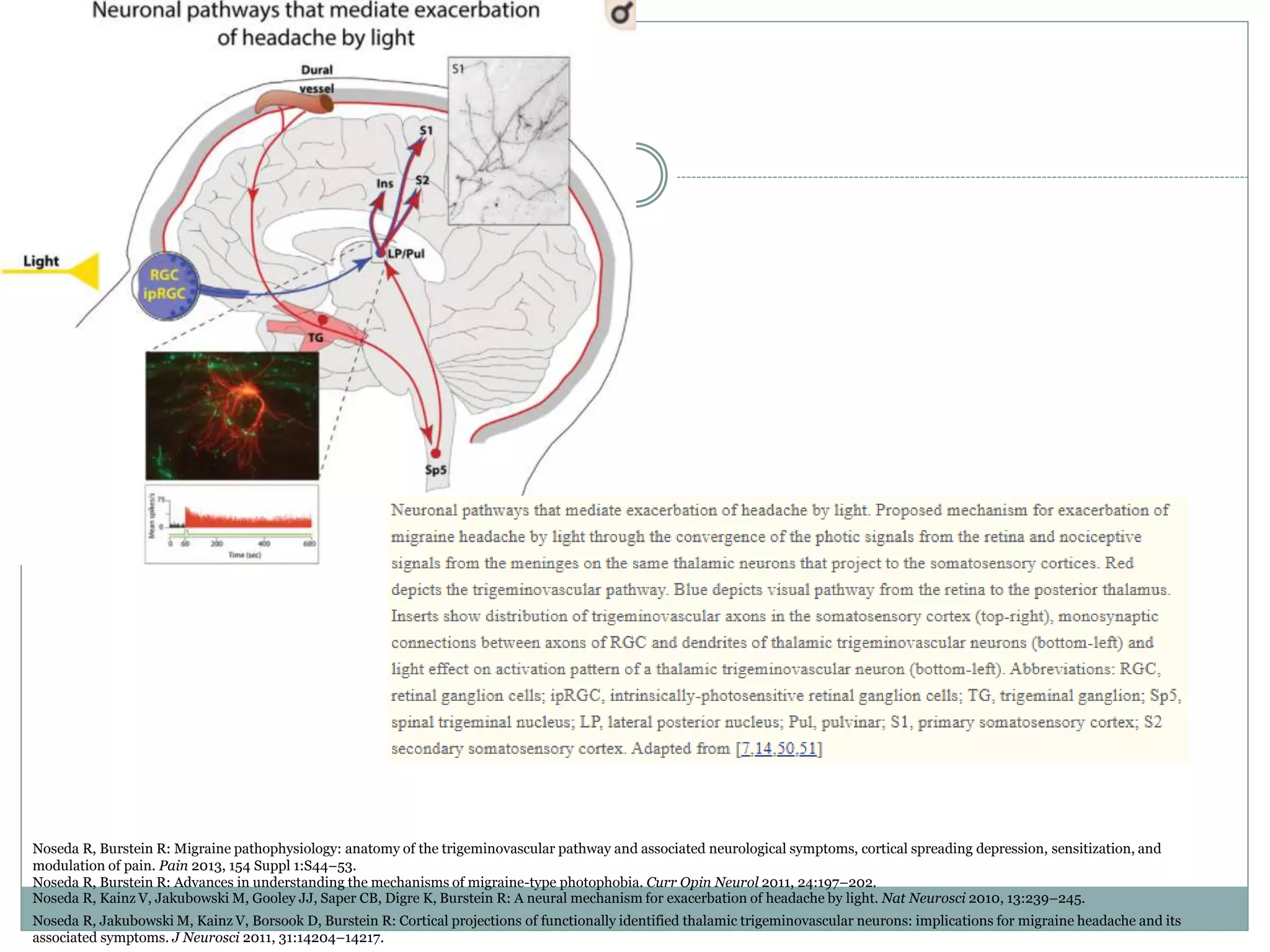 The Neuromechanism of Photophobia | PPTX