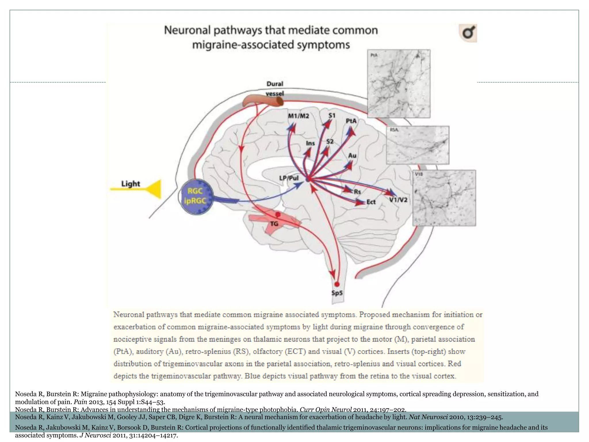 The Neuromechanism of Photophobia | PPTX