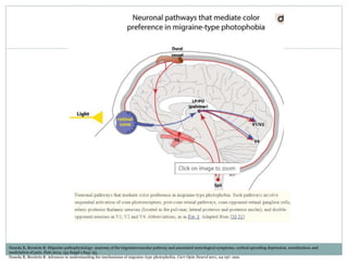 The Neuromechanism of Photophobia | PPTX