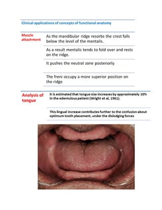 The neutral zone concept in complete denture final | DOCX