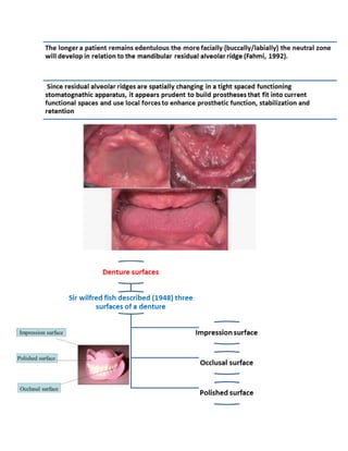 The neutral zone concept in complete denture final | DOCX