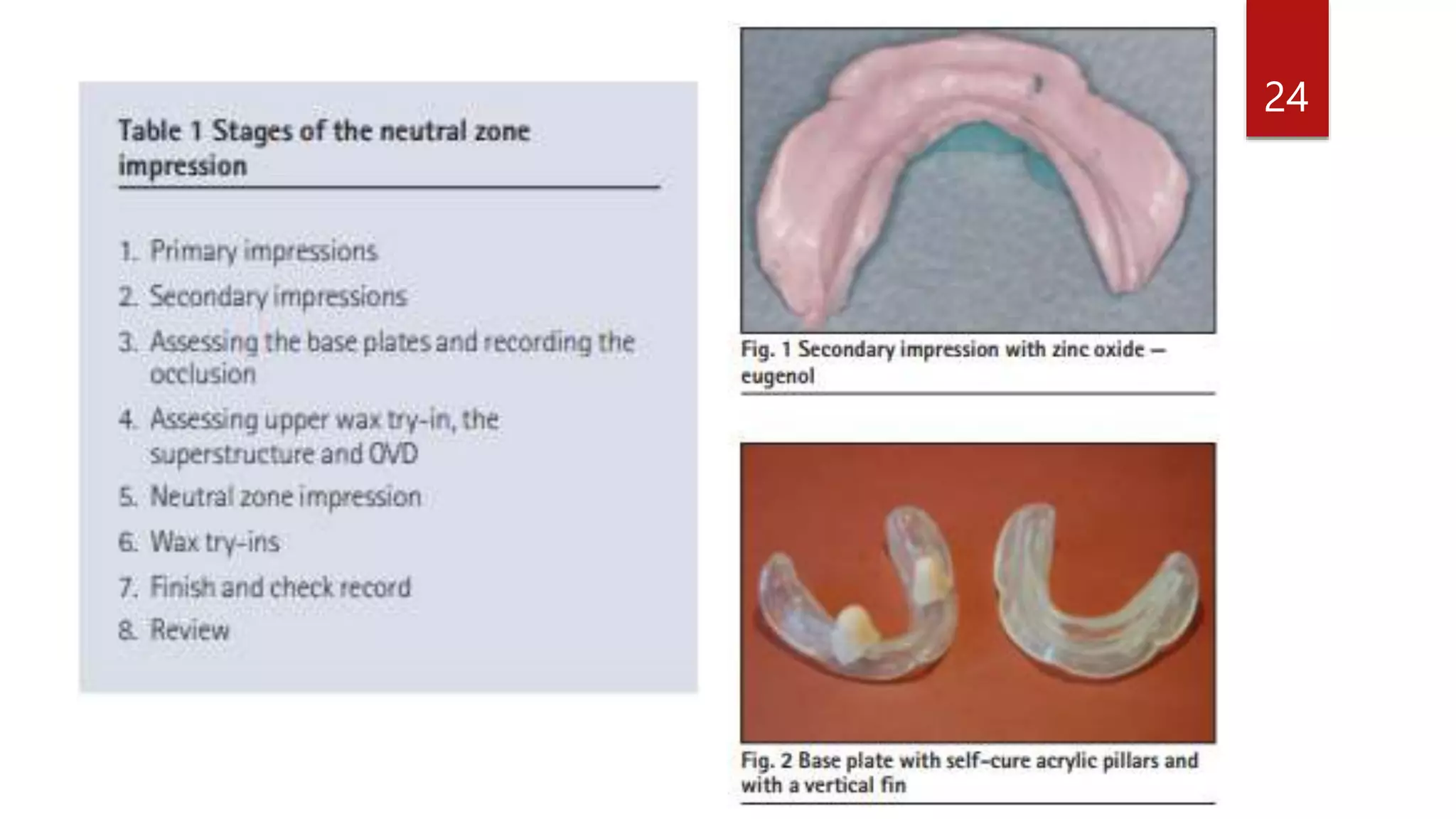 The Neutral zone in complete dentures.pptx