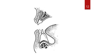 The Neutral zone in complete dentures.pptx