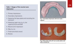 The Neutral zone in complete dentures.pptx