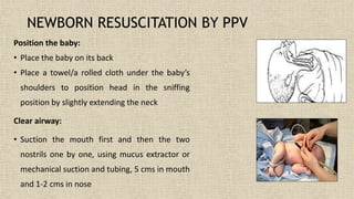 THE NEWBORN CARE.pptx