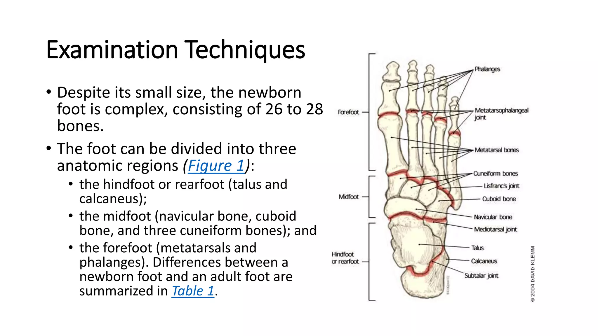 The newborn foot anomalies | PPTX