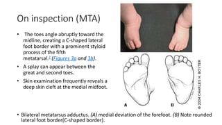 The newborn foot anomalies | PPTX | Death, Injury, or Military Conflict ...