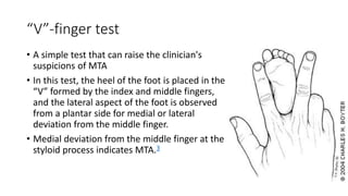 The newborn foot anomalies | PPTX | Death, Injury, or Military Conflict ...