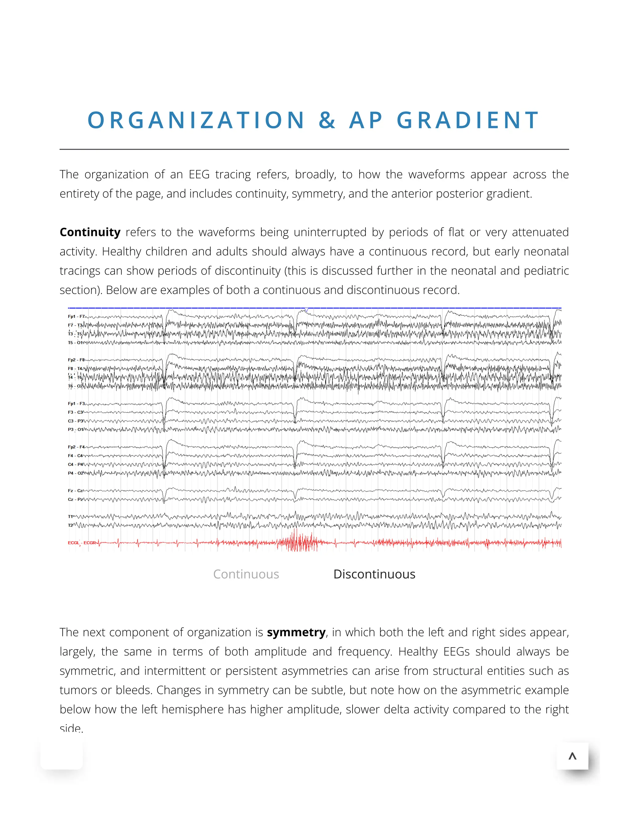 The normal awake eeg and how to under .. | PDF