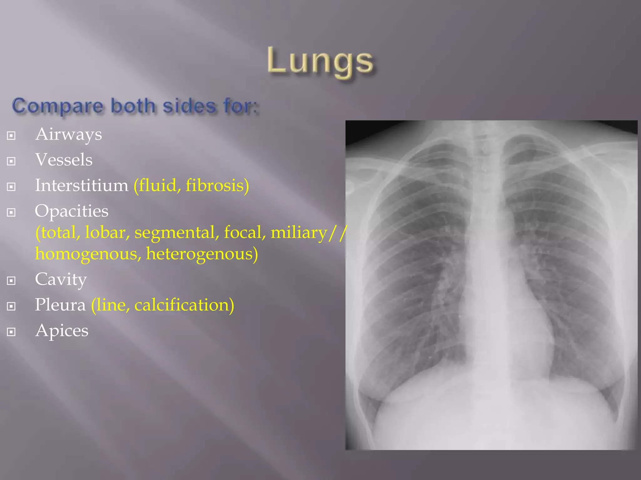 The Normal Chest X-ray | PPT