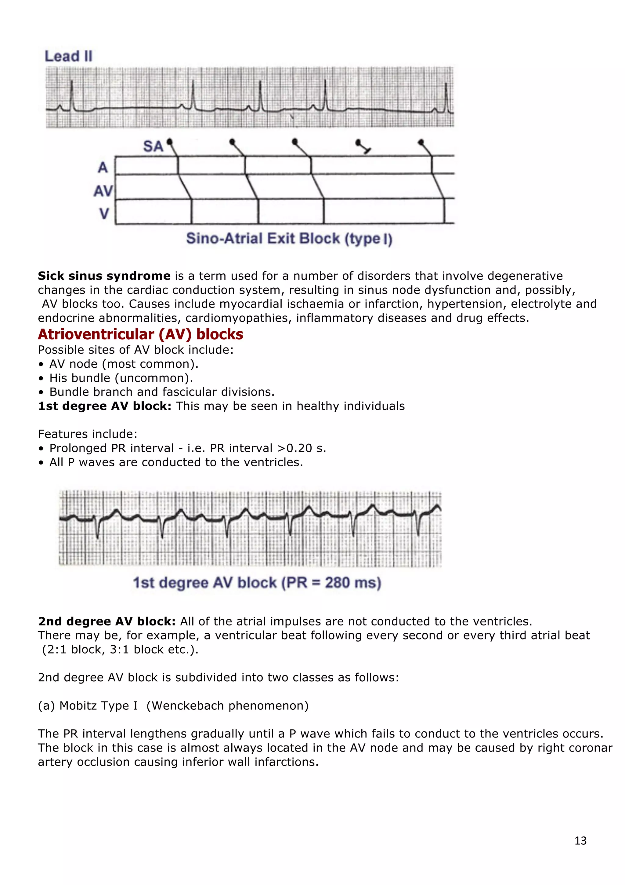 The normal ecg and the 12 | PDF | Chemistry | Science