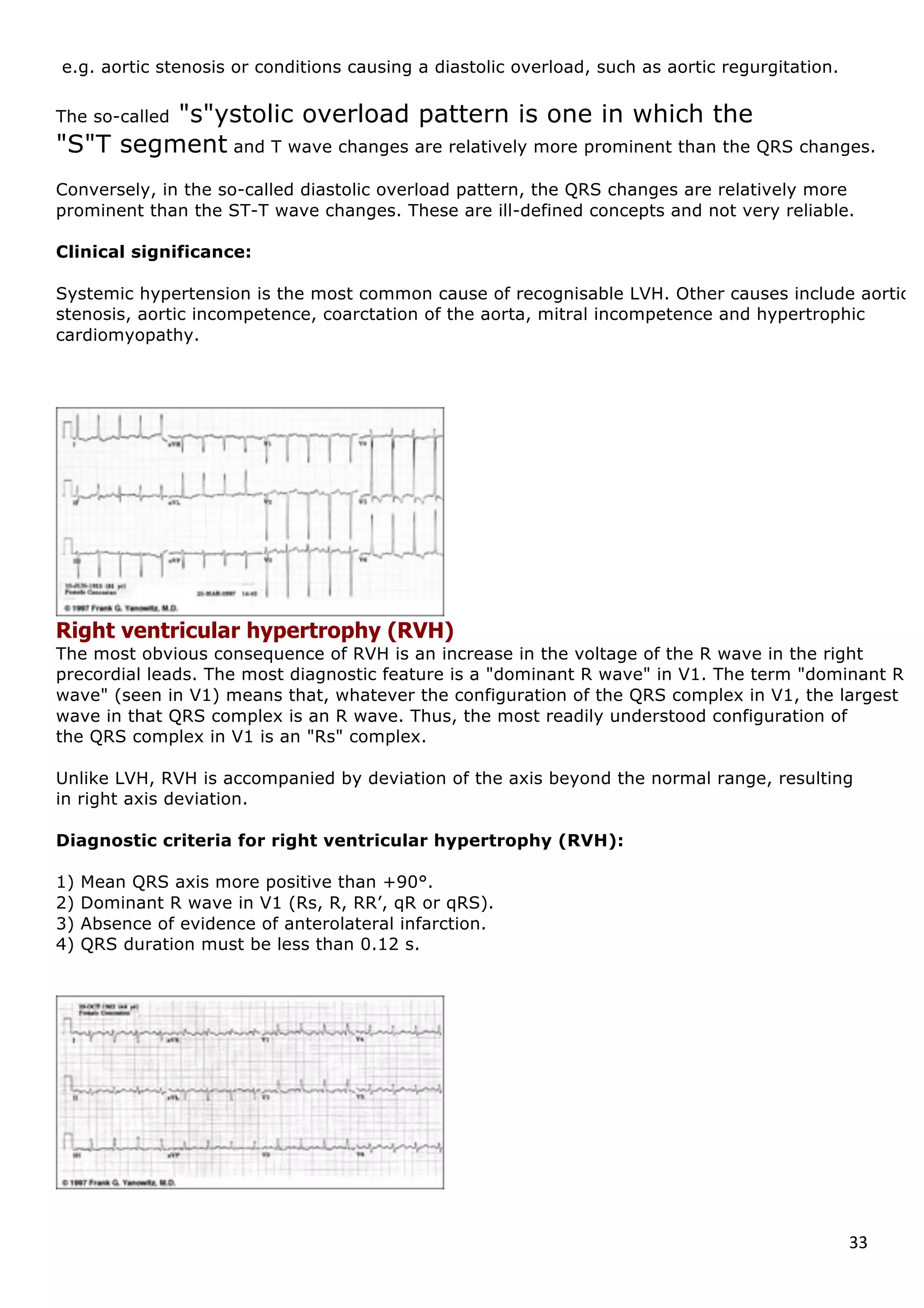 The normal ecg and the 12 | PDF