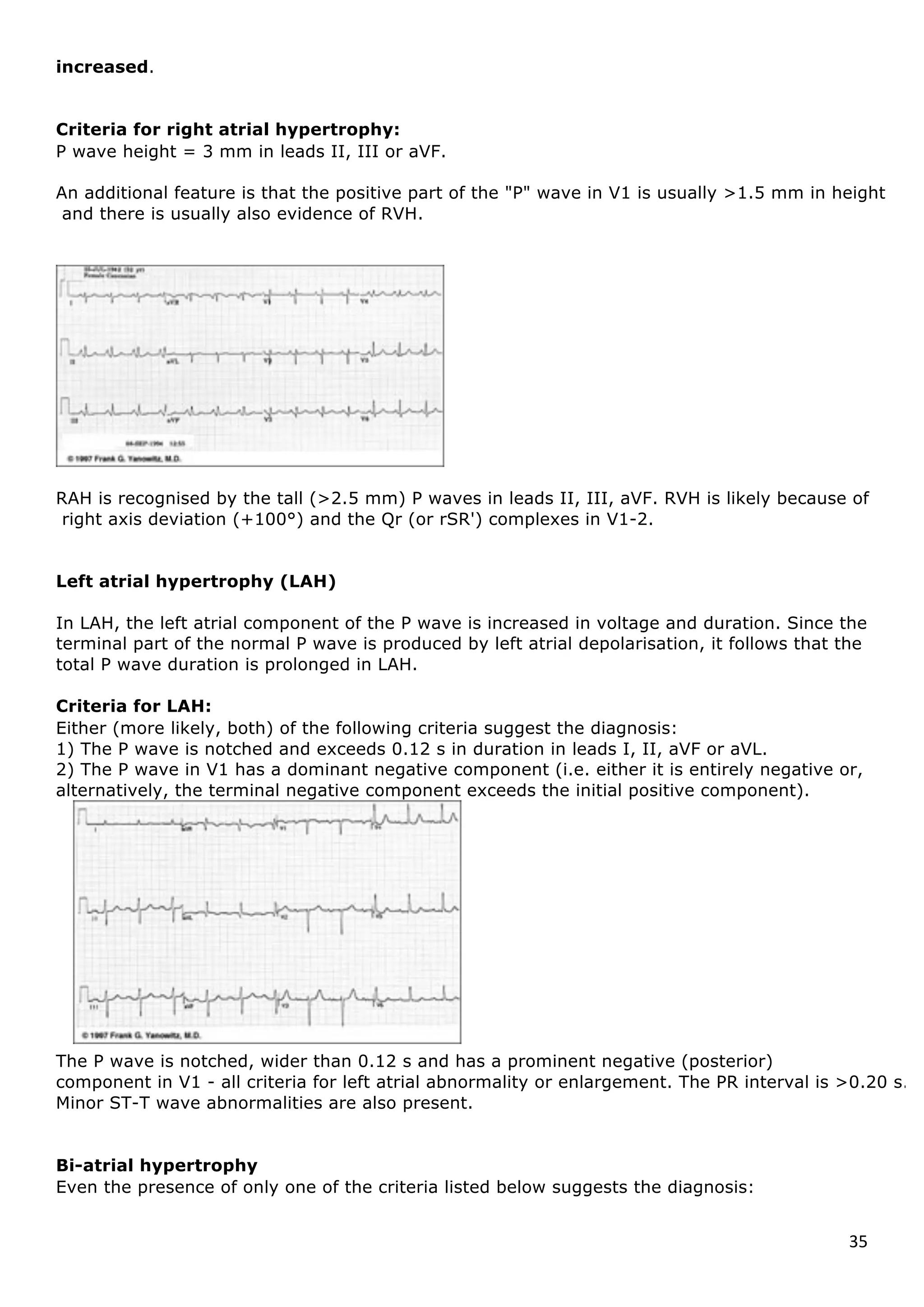 The normal ecg and the 12 | PDF | Chemistry | Science