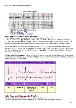 The normal ecg and the 12 | PDF