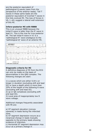 The normal ecg and the 12 | PDF