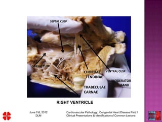 The Normal Heart: Review of Important Anatomic Landmarks | PPTX