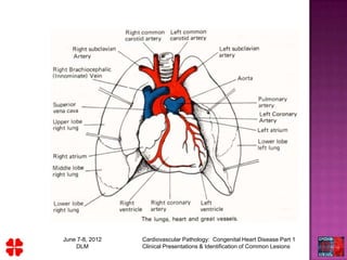 The Normal Heart: Review of Important Anatomic Landmarks | PPTX