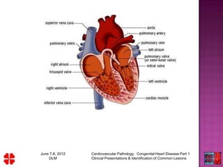 The Normal Heart: Review of Important Anatomic Landmarks | PPTX