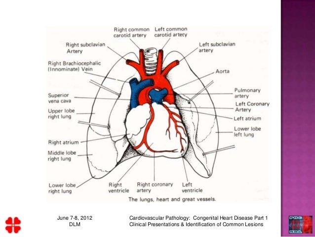 The Normal Heart: Review of Important Anatomic Landmarks