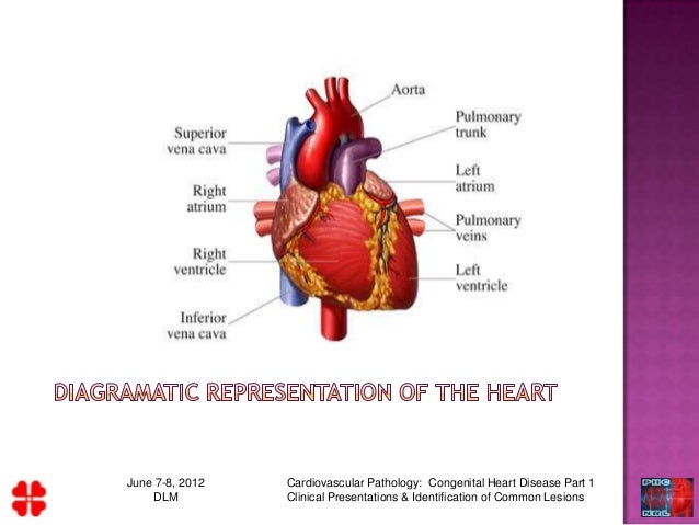 The Normal Heart: Review of Important Anatomic Landmarks