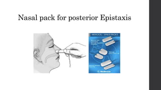 The Nose and nasal cavity, anatomy, and clinical diseases of nasal ...