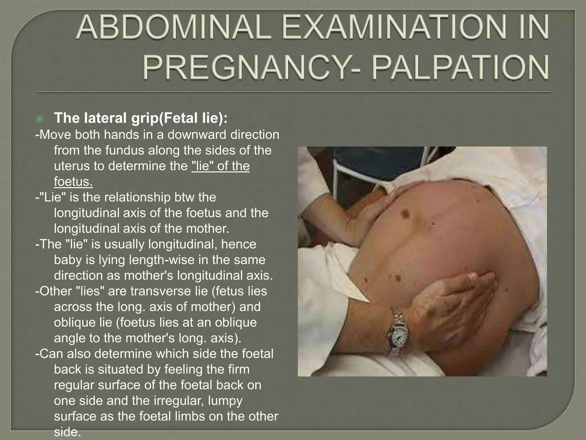 The obstetric examination ppt | PPTX