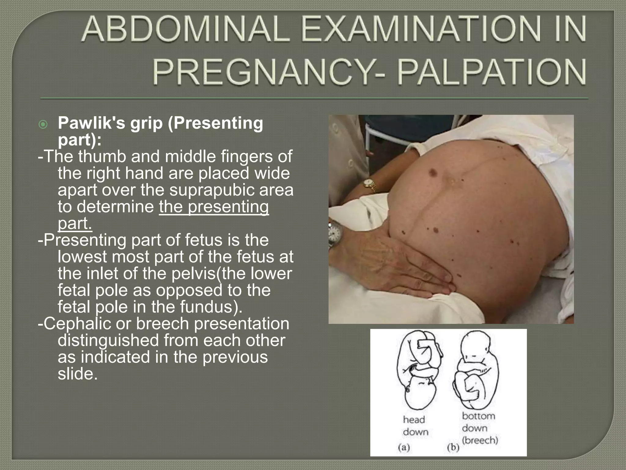 The obstetric examination ppt | PPTX