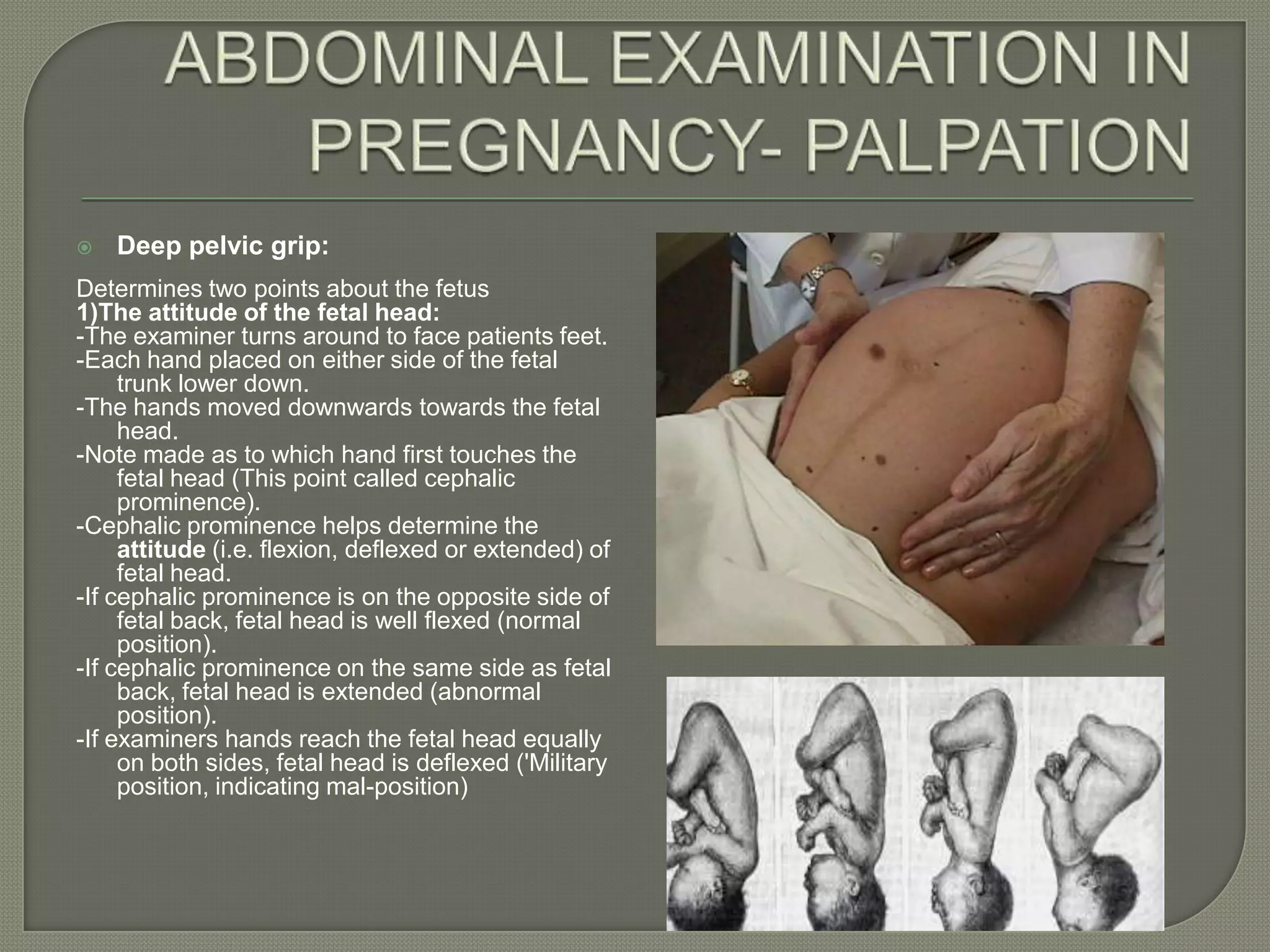 The obstetric examination ppt | PPTX
