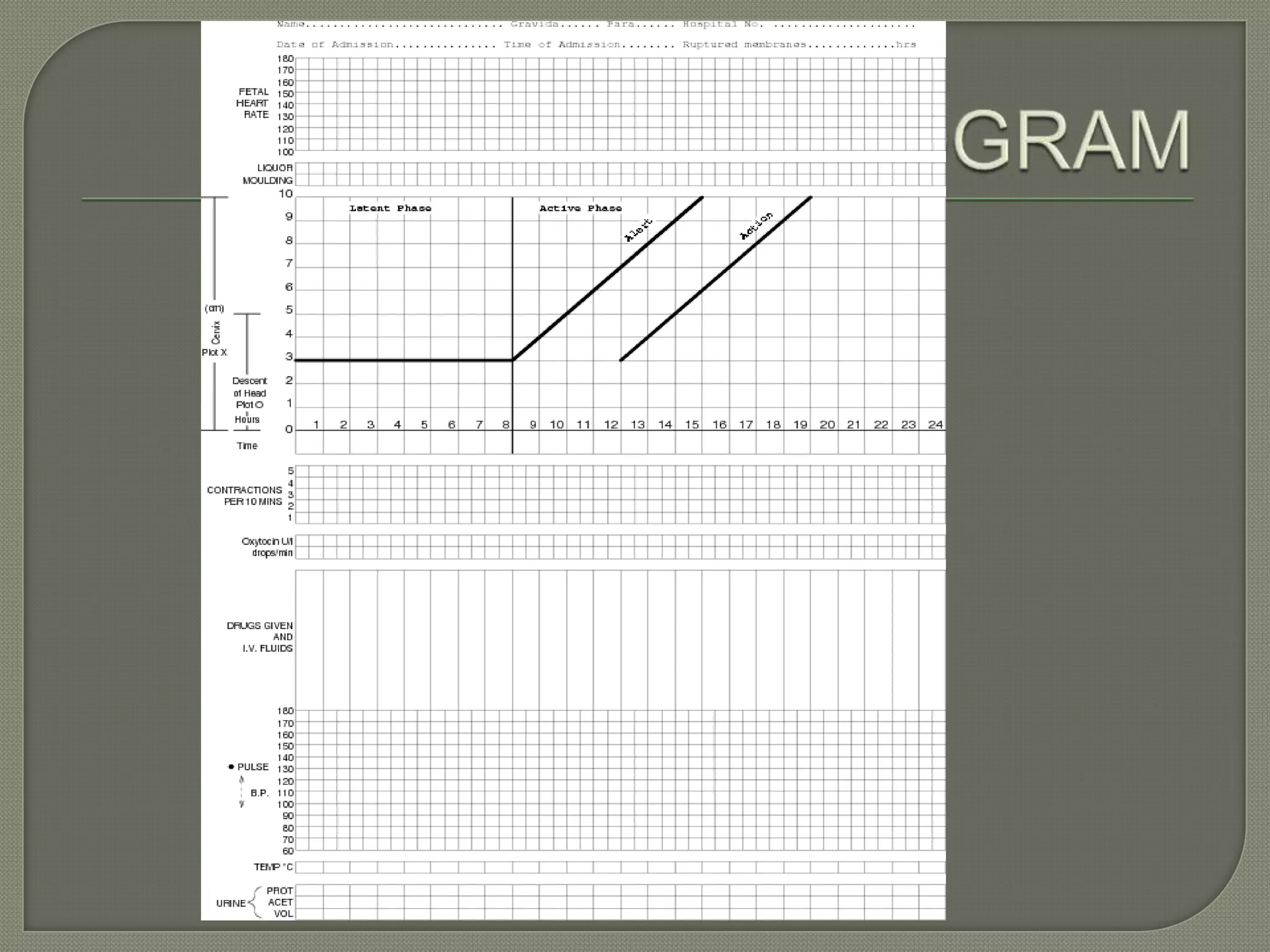 The obstetric examination ppt | PPTX