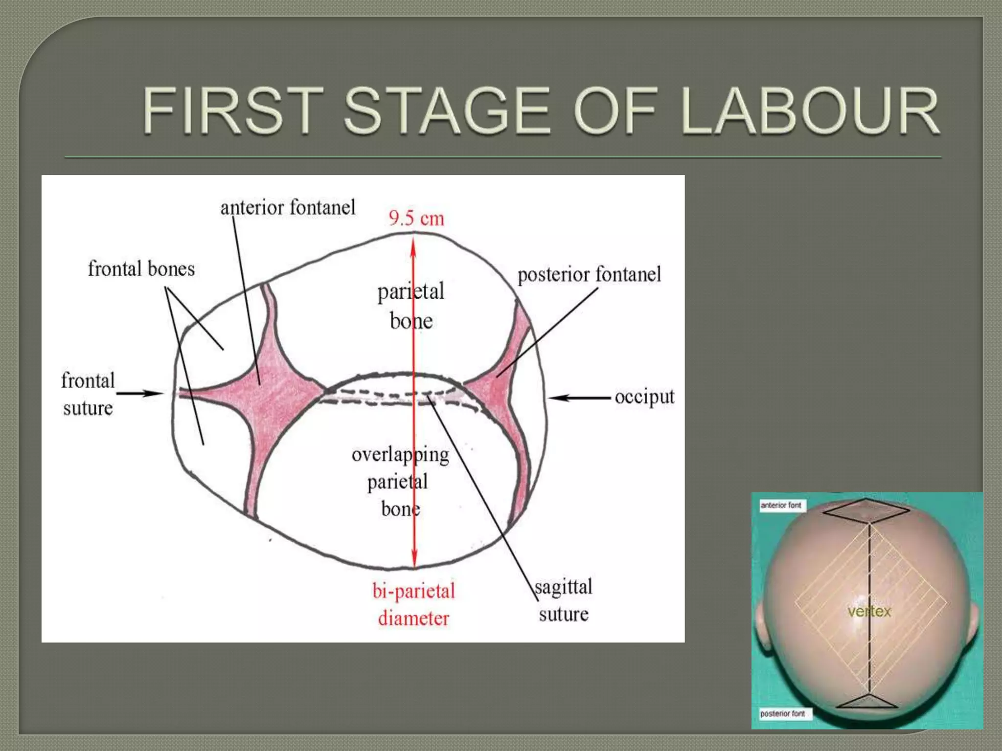 The obstetric examination ppt | PPTX