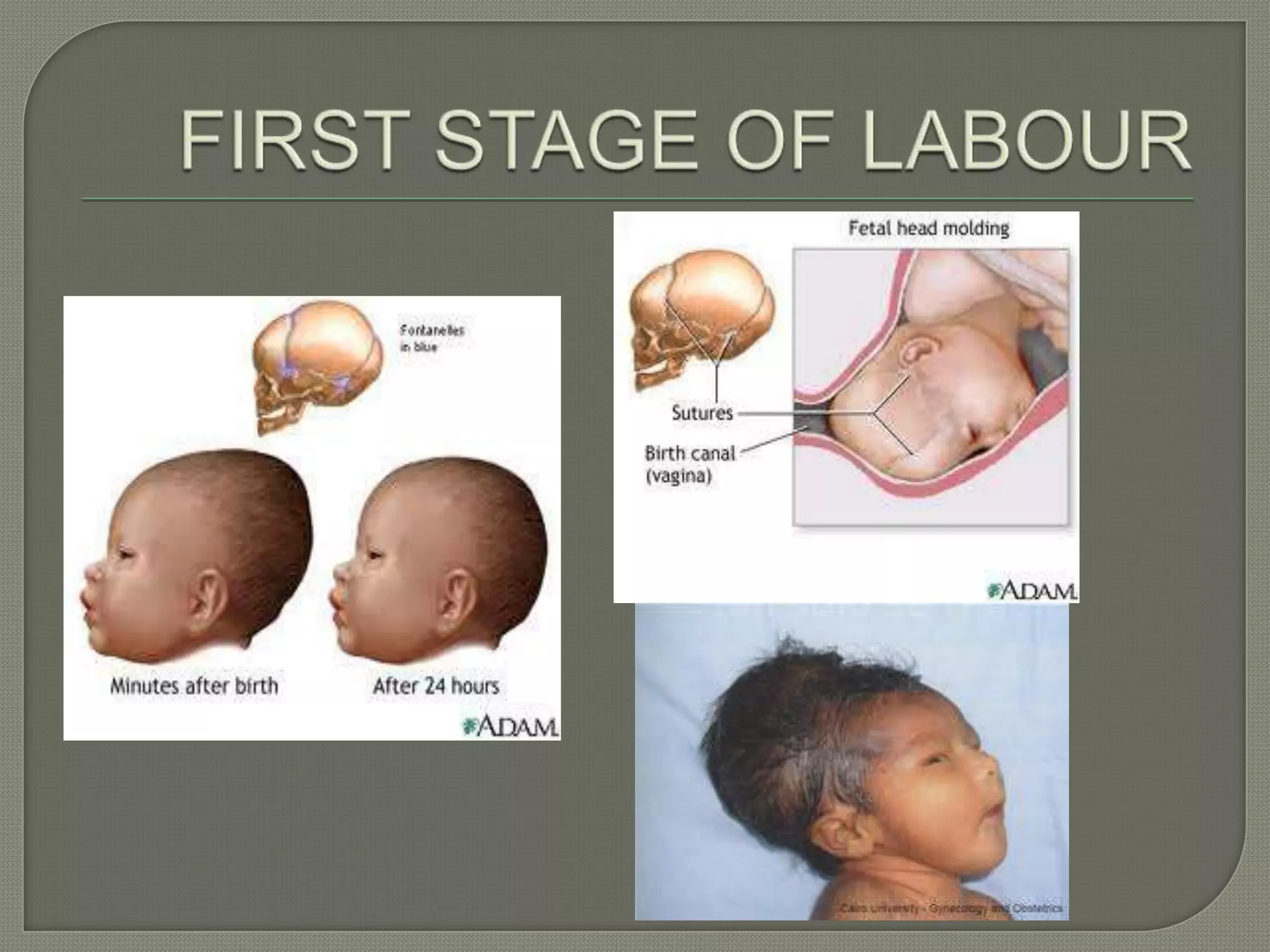 The obstetric examination ppt | PPTX