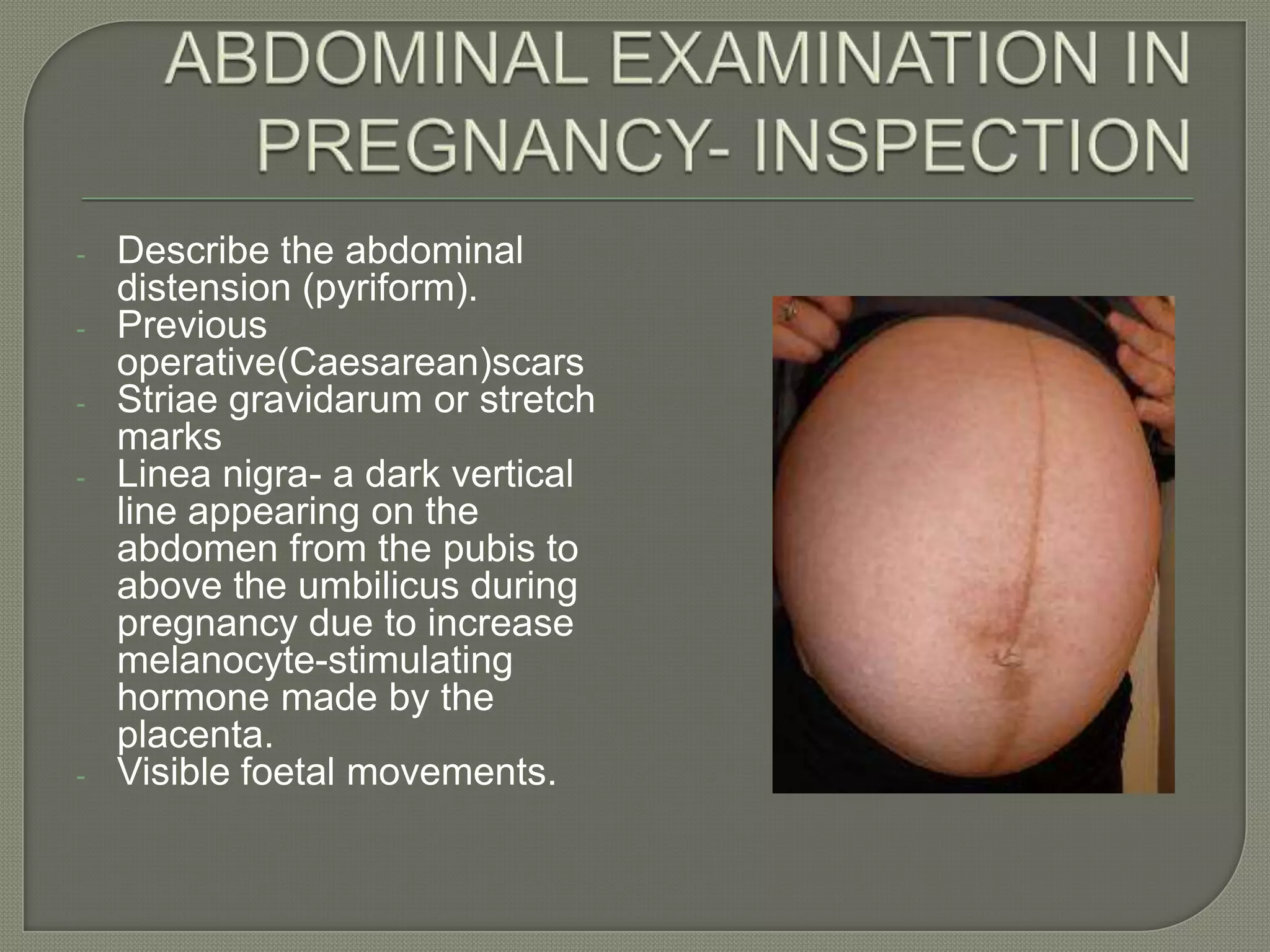The obstetric examination ppt | PPTX