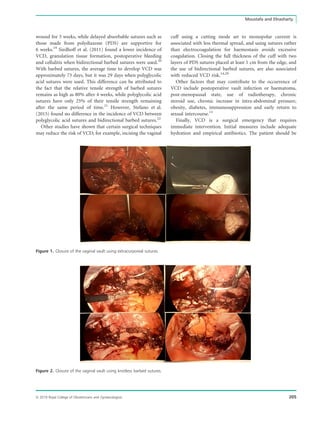 The Obstetric Gynaecologis - 2019 - Moustafa - Issues around vaginal ...